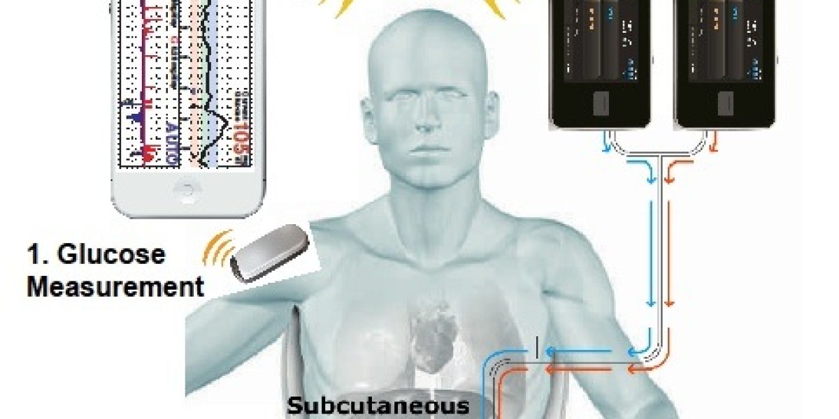 Apple-powered bionic pancreas one-step closer. | Fortune