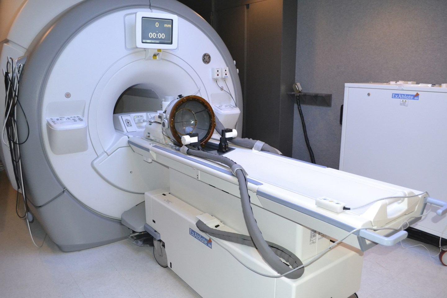 This is your brain on … surgical sound waves | Fortune