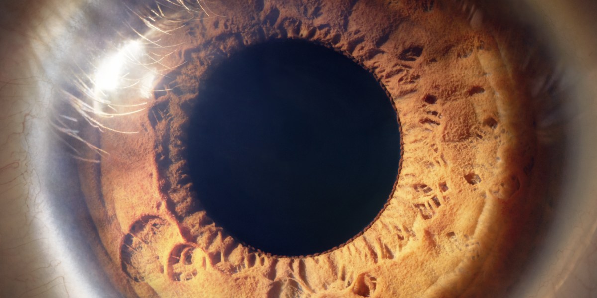 This Bionic Lens Implant Could Give Everybody Perfect Vision | Fortune