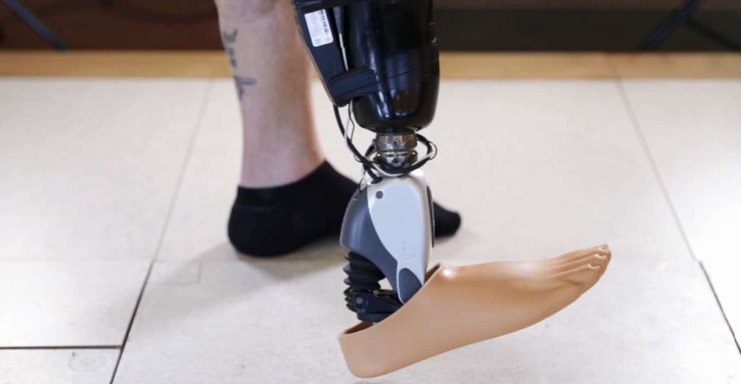 Bionic Limbs Use Mind-control To Function Via Icelandic Company Ossur ...