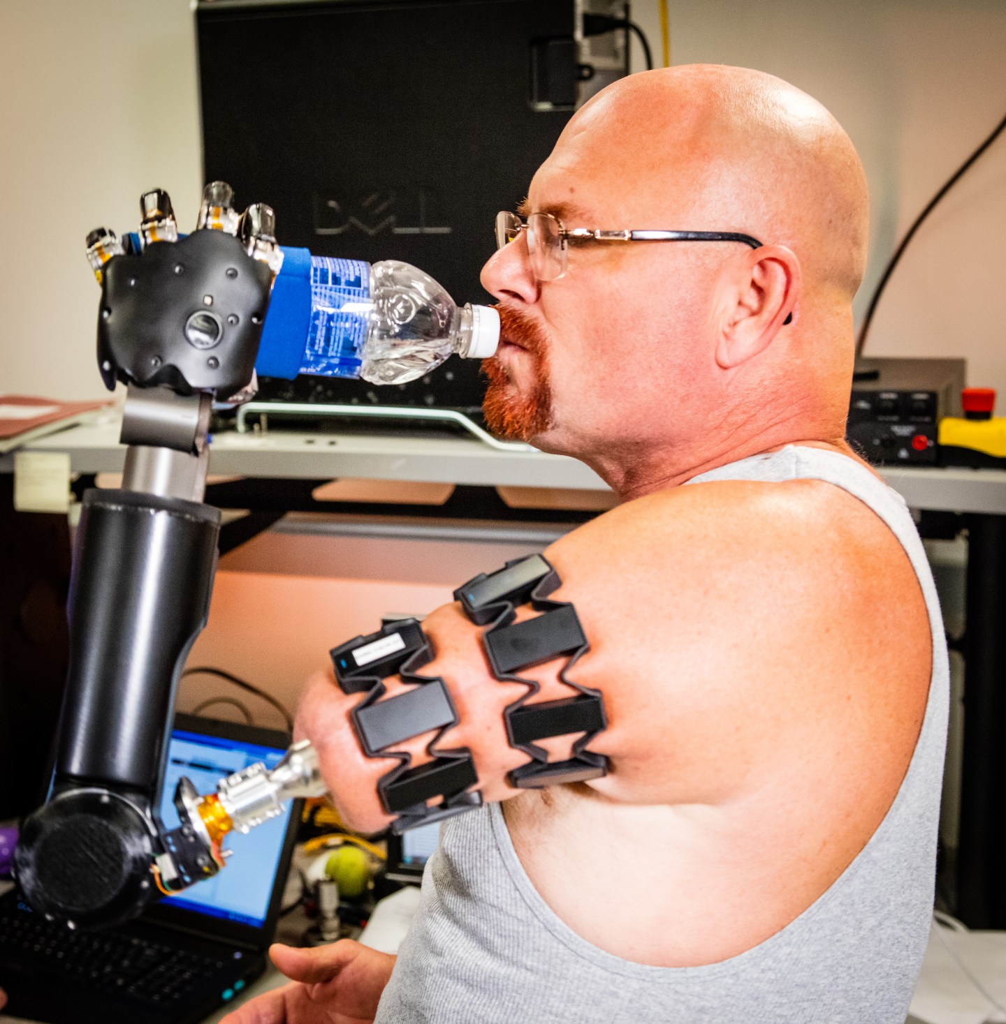 The Consumer Wearable Powering Next-Gen Prosthetics | Fortune