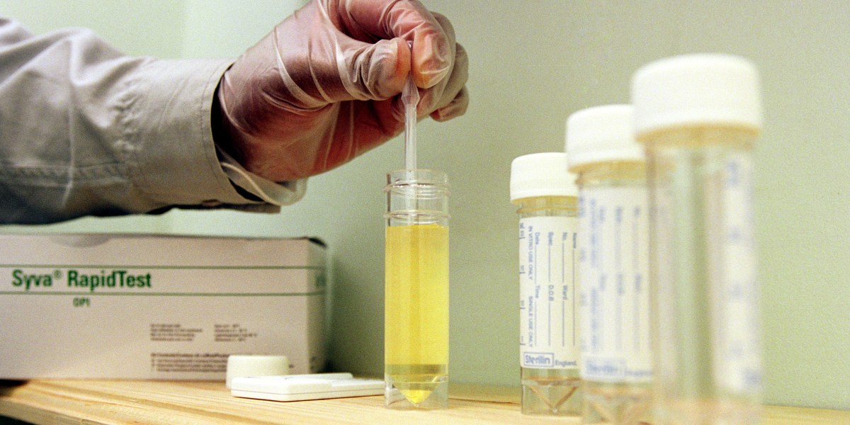 Opioid Crisis: Urine Test Business Booms, Raises Questions | Fortune