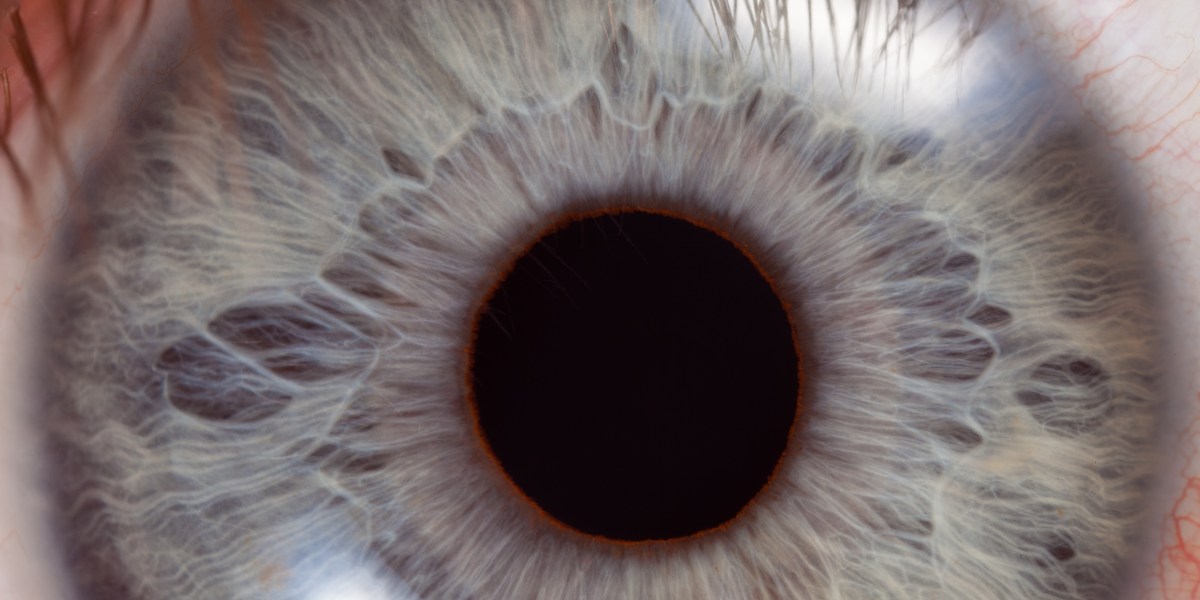 Rare Eye Cancer Ocular Melanoma Has Started to Appear in 2 States | Fortune