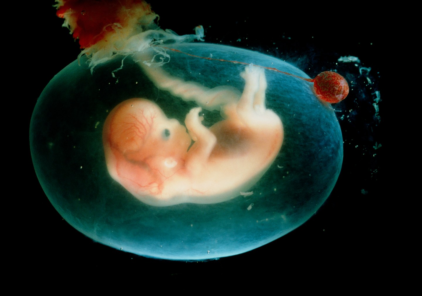 New Studies: Frozen Embryos Not Always Necessary for IVF | Fortune