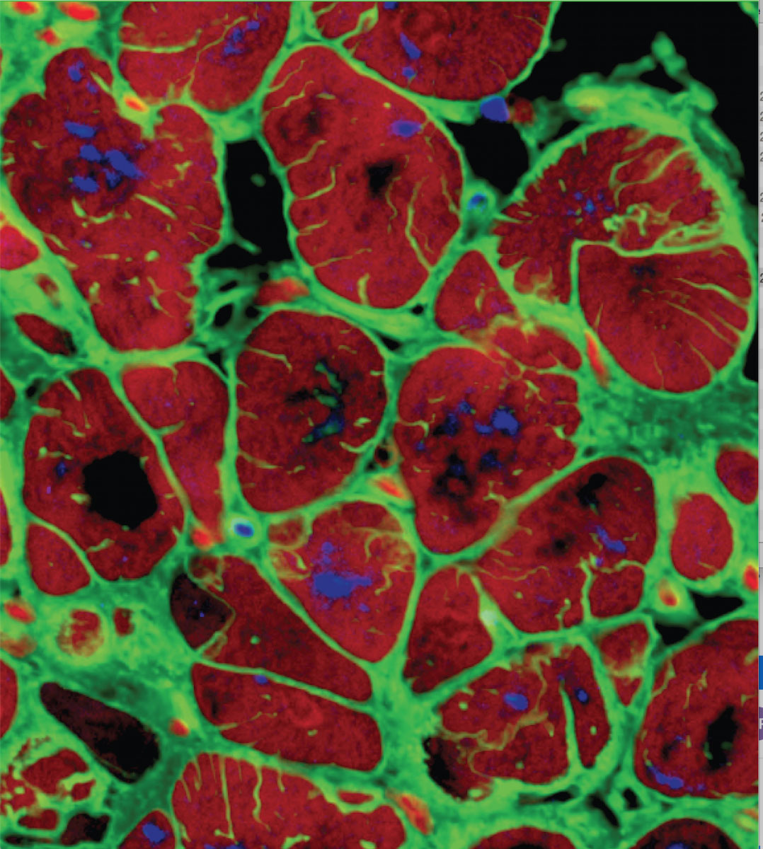 Columbia Researchers Grew Tissue That Acts Like Human Heart Muscle ...