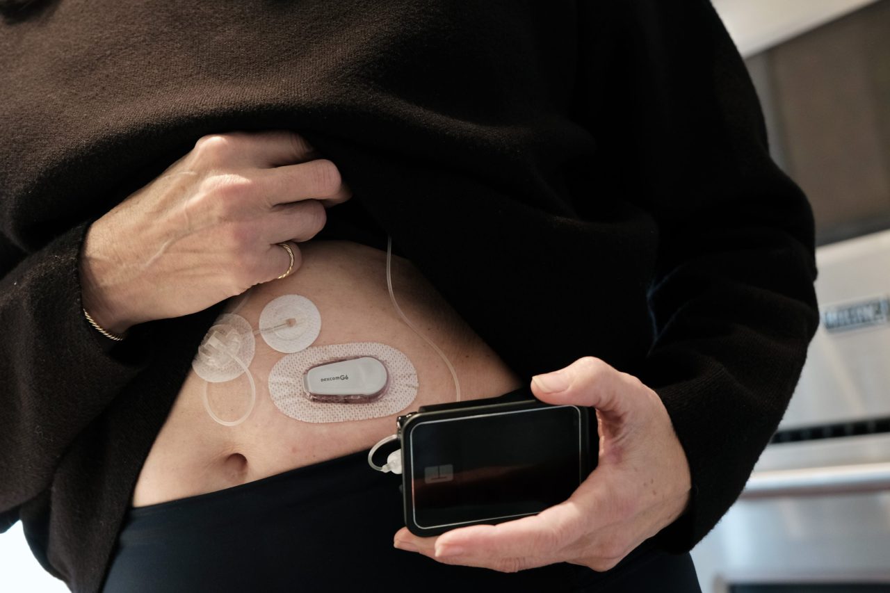 New Eli Lilly obesity drug expected to be best.seller | Fortune