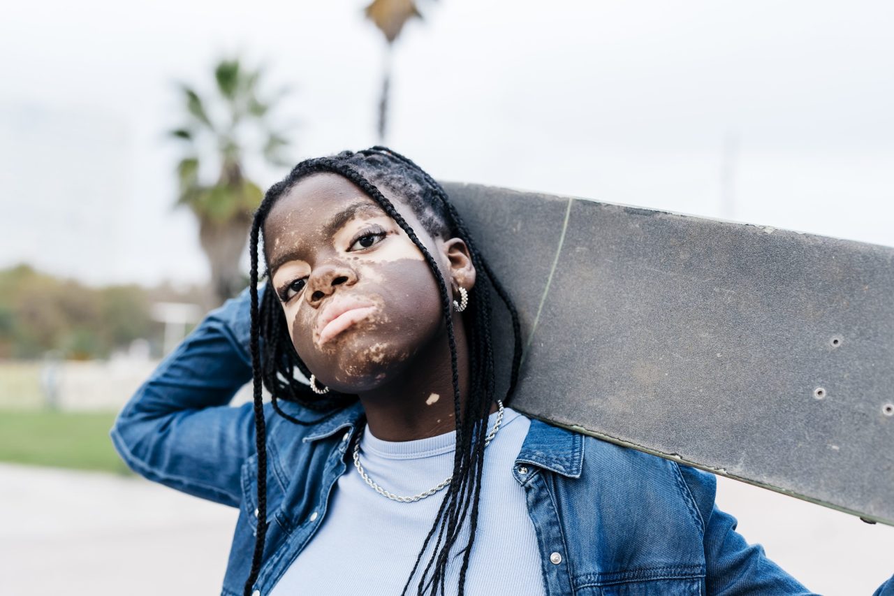 Autoimmune diseases like lupus, MS, and rheumatoid arthritis strike far ...